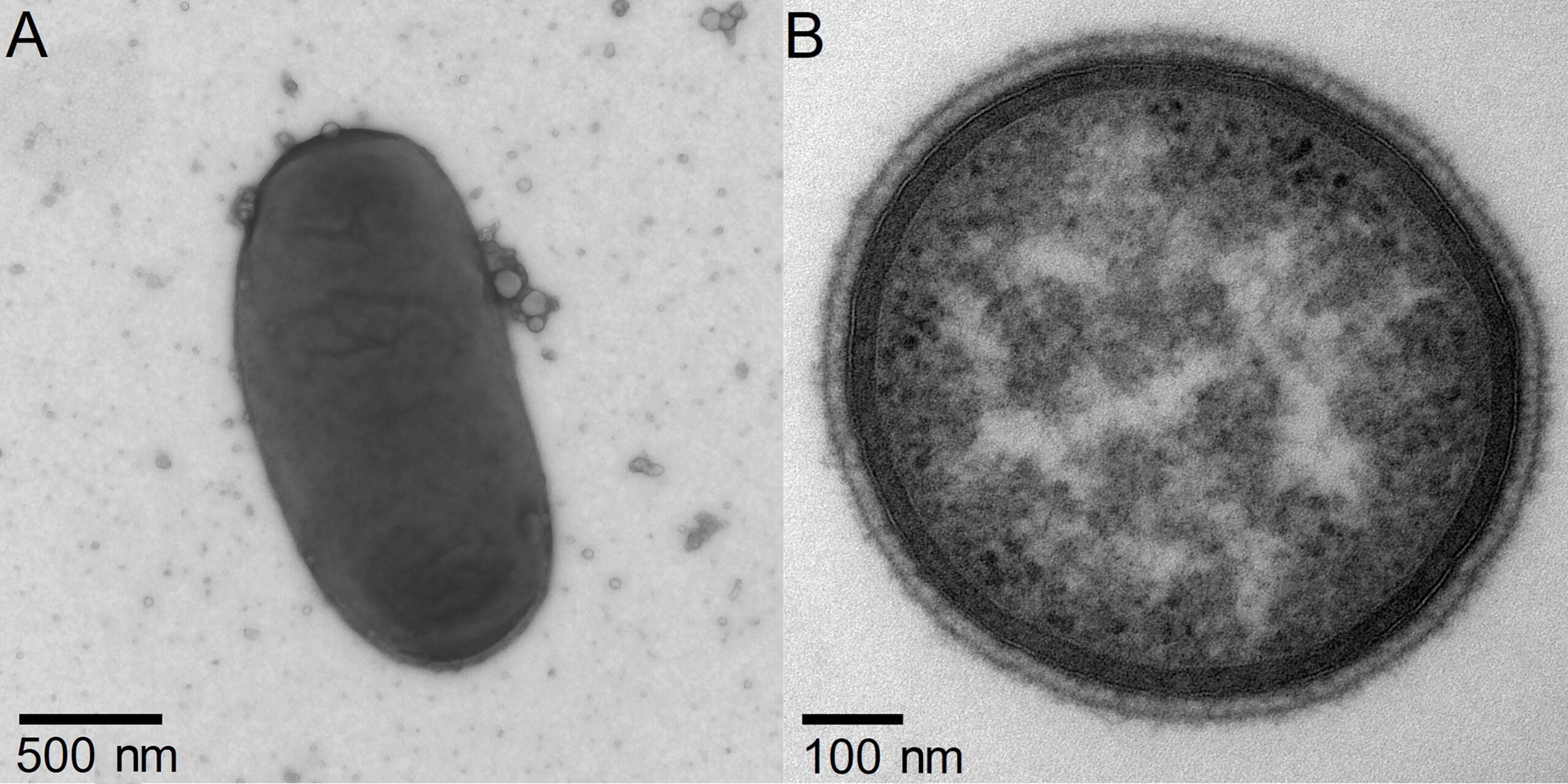 New bacterial species discovered in the intestine | CRC 1182